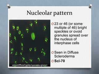 ANA in autoimmunity by DR. ANAMIKA DEV | PPTX | Lung and Respiratory ...