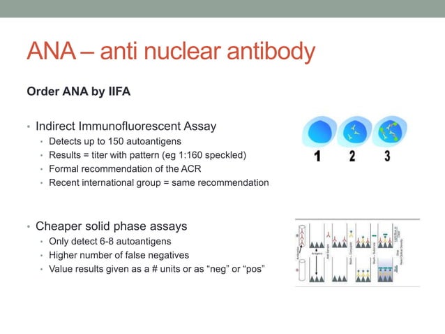 Connective Tissue Diseases