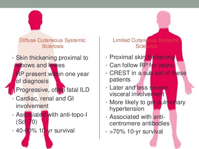 Connective Tissue Diseases