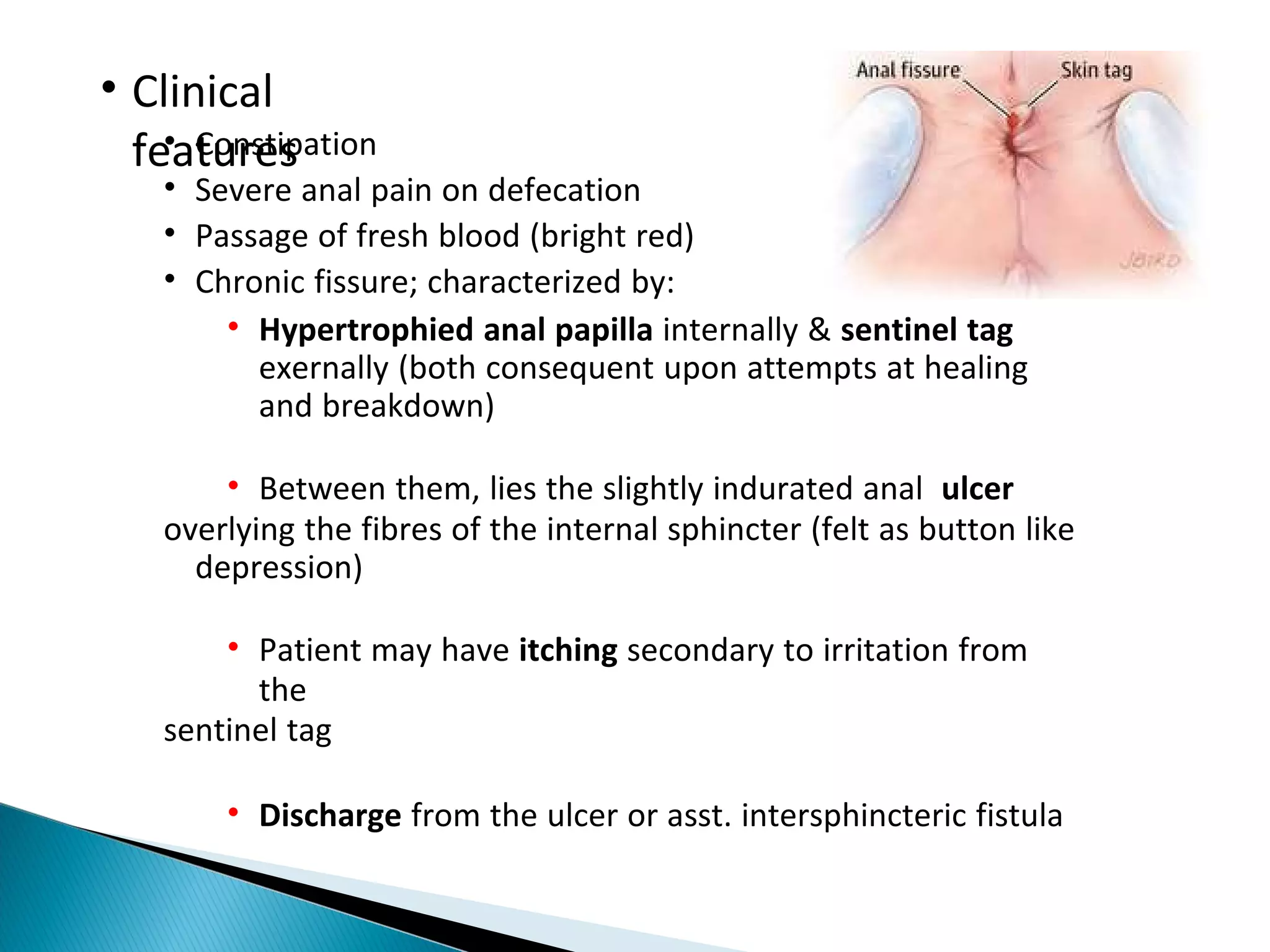 Anal and perianal diseases | PPT