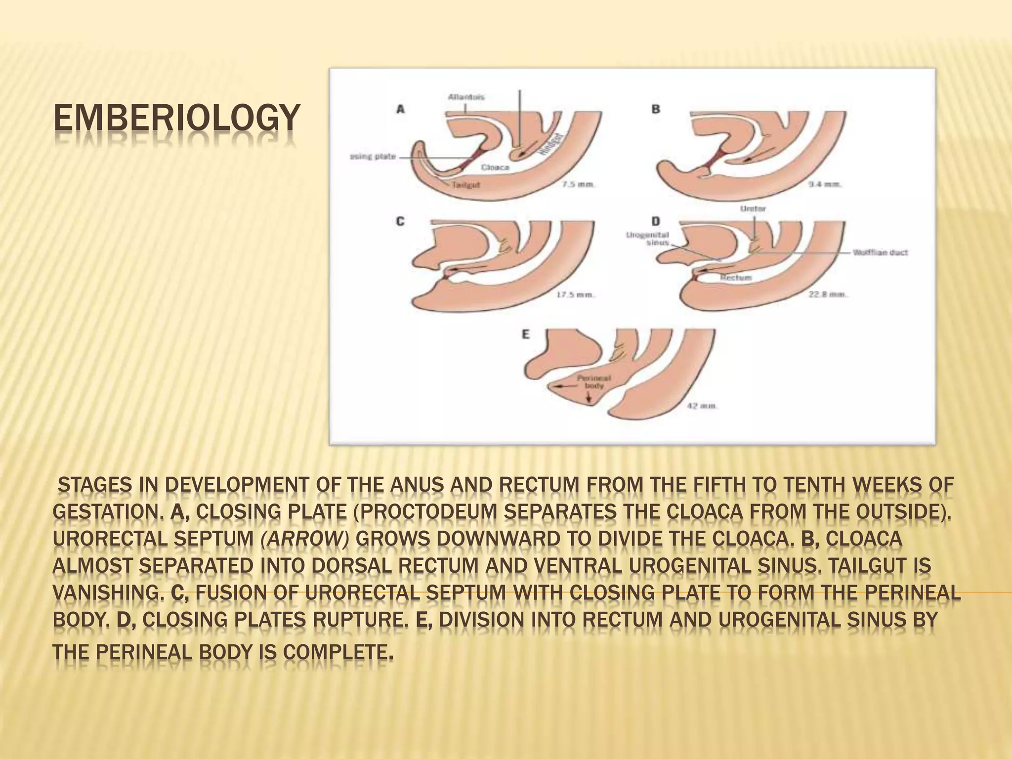 Anal carcinoma | PPTX