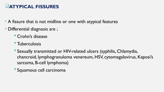 Anal fissure or fissure-in-ano12345.pptx
