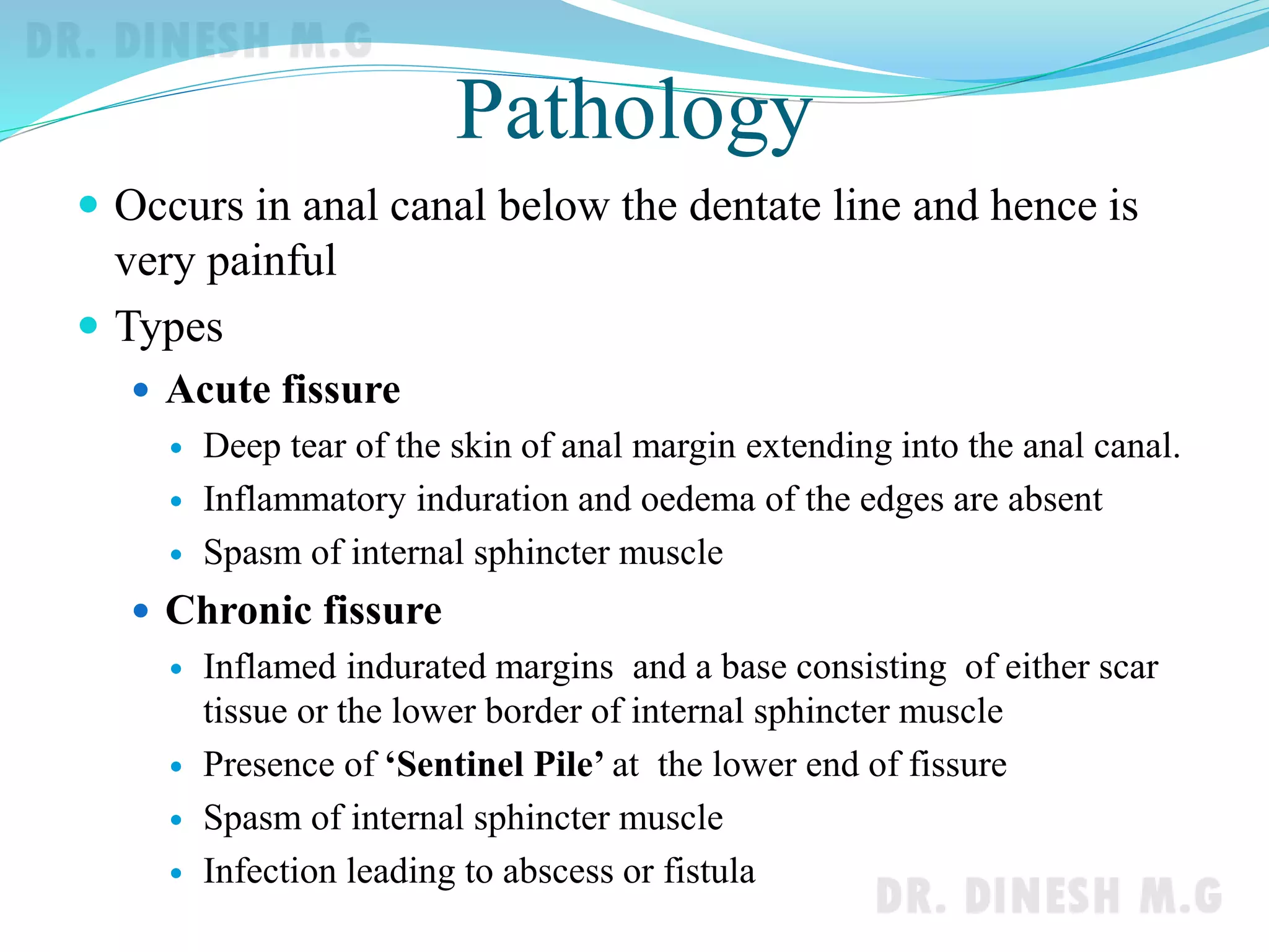 Anal Fissure | PPTX