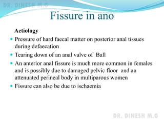 Anal Fissure | PPTX