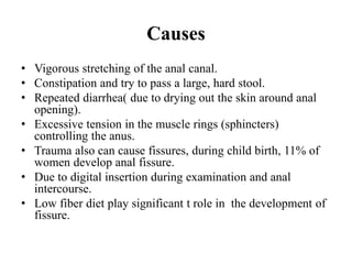 Anal Fissure.pptx