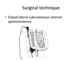 anal fissure.pptx........................... | PPTX
