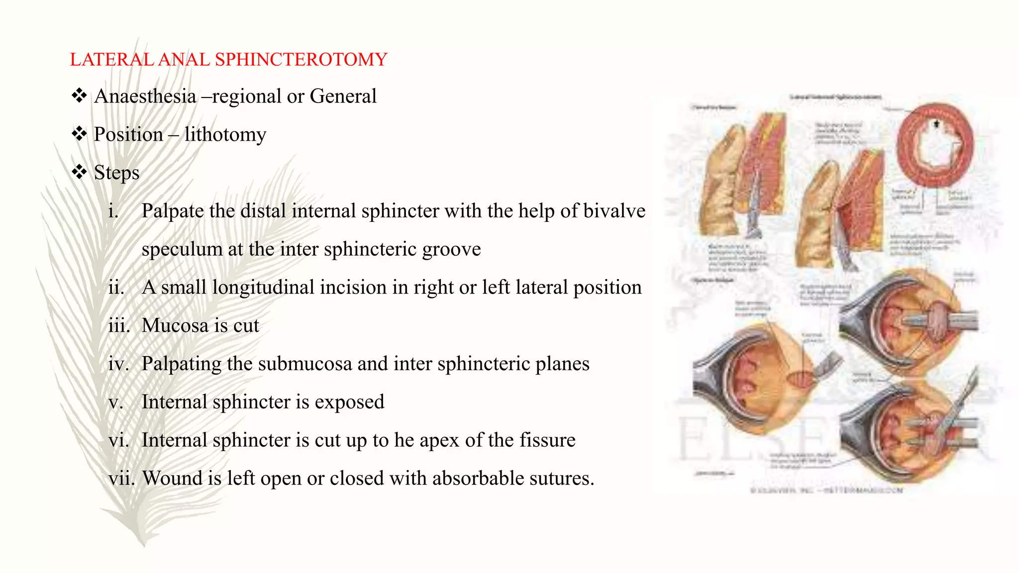 Anal fissure and haemrrhoid | PPTX