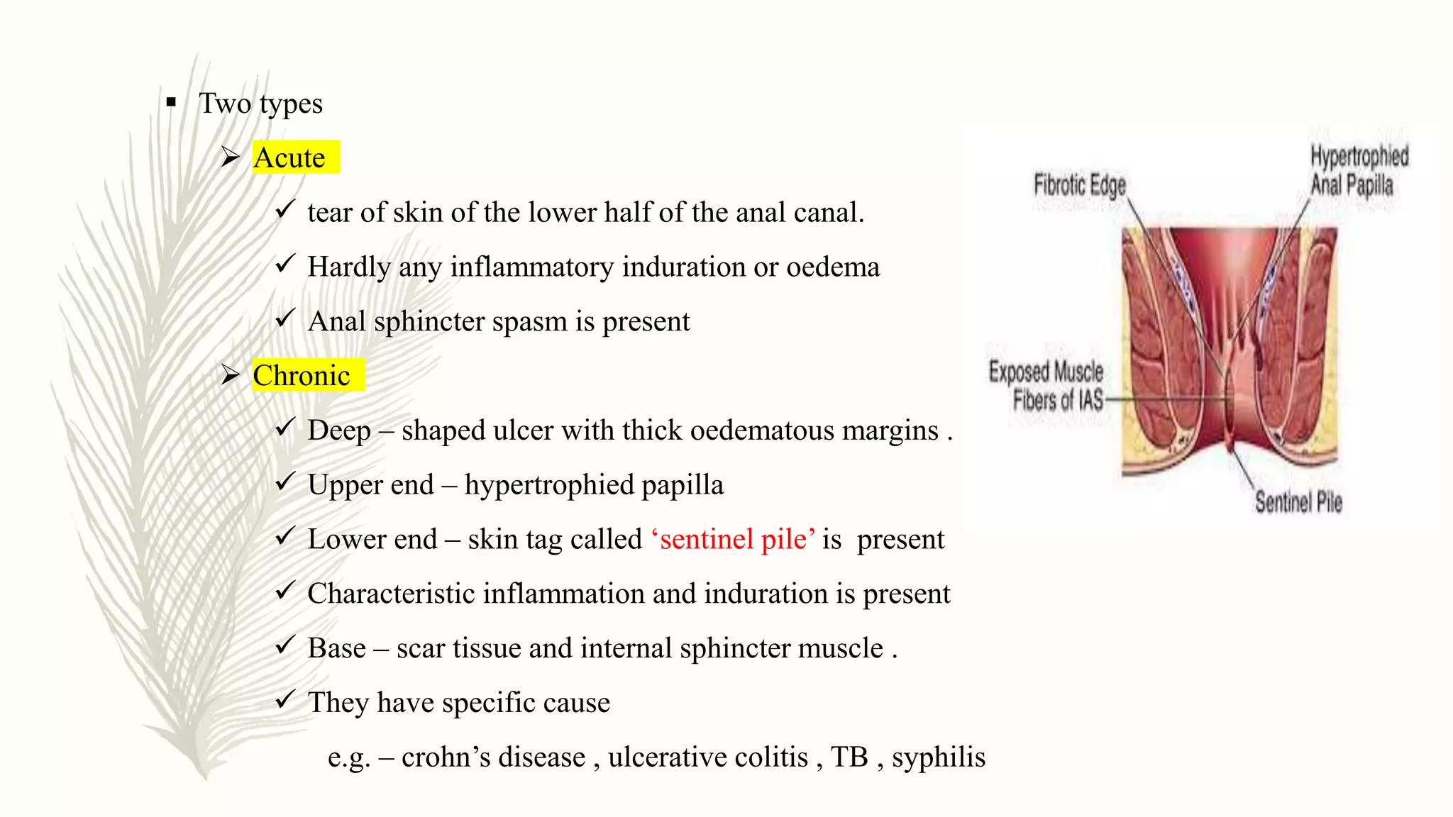 Anal fissure and haemrrhoid | PPTX