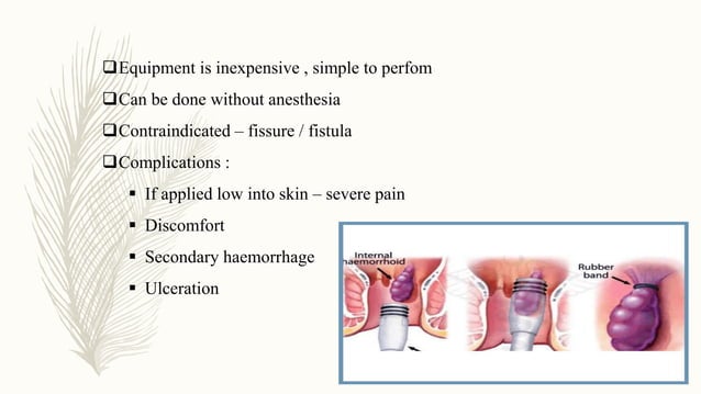 Anal fissure and haemrrhoid | PPTX | Digestive Disorders | Diseases and ...