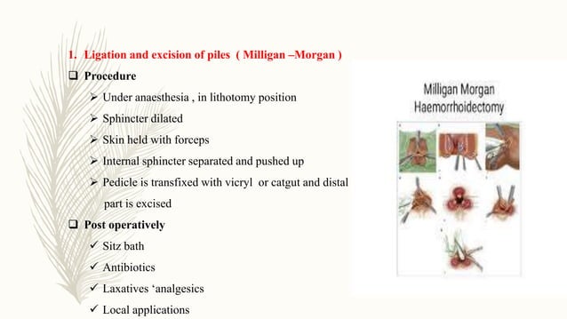 Anal fissure and haemrrhoid | PPTX | Digestive Disorders | Diseases and ...
