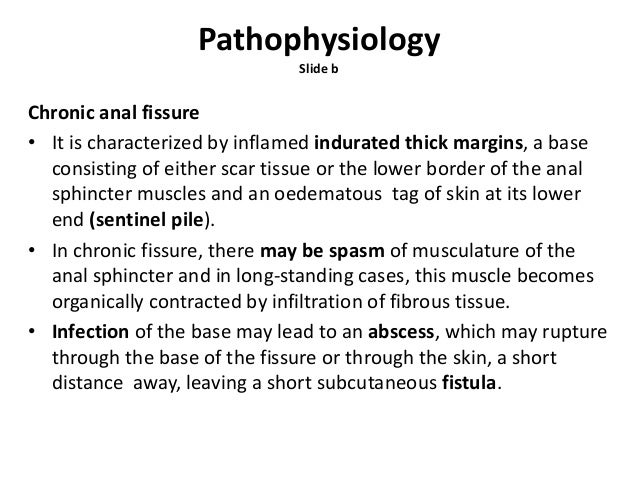 Anal fissure (fissure in ano) | PPSX