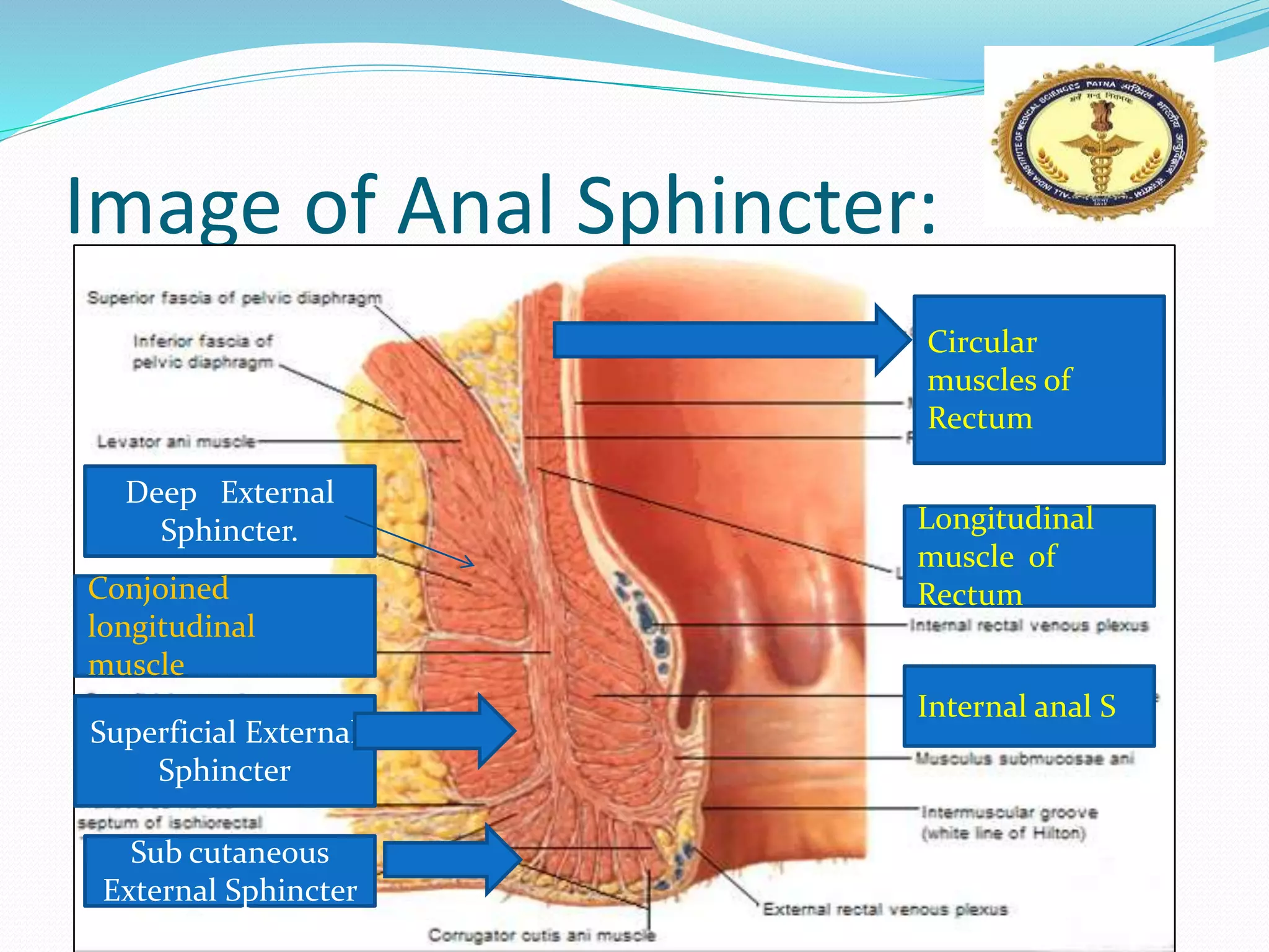 PPT by Dr Anil Kumar, Assitant Professor, AIIMS,Patna on Anal Fissure & Fistula in Ano | PPTX