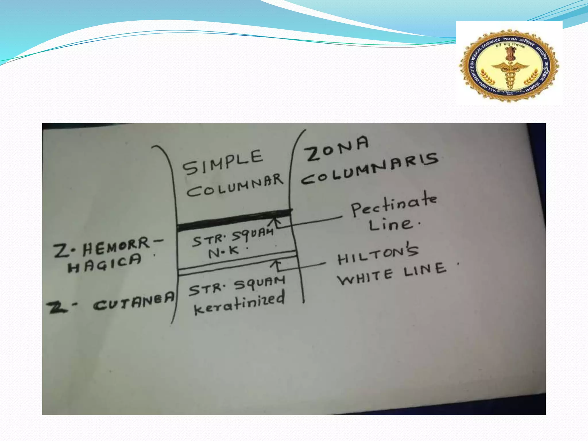 PPT by Dr Anil Kumar, Assitant Professor, AIIMS,Patna on Anal Fissure ...