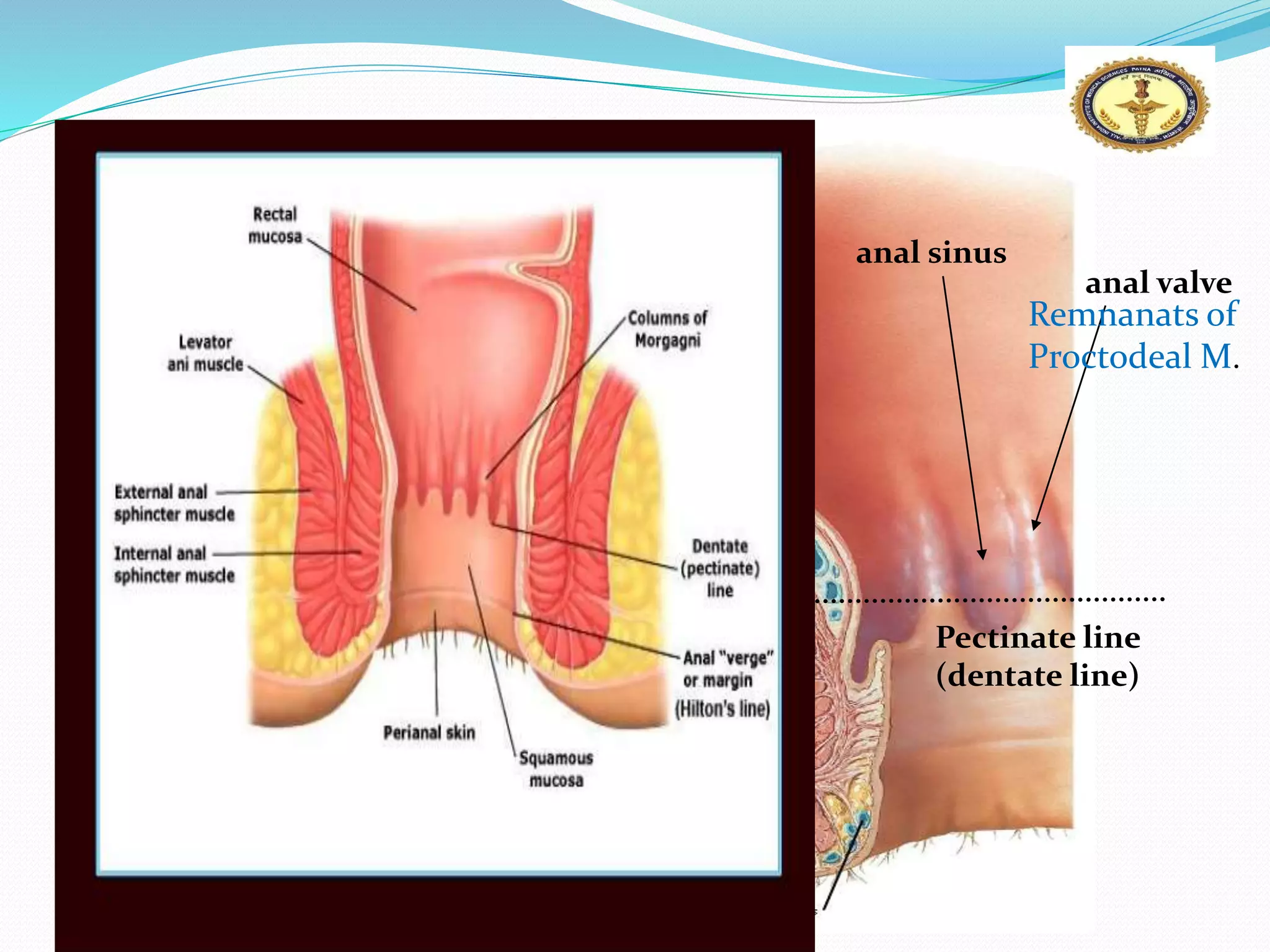 PPT by Dr Anil Kumar, Assitant Professor, AIIMS,Patna on Anal Fissure & Fistula in Ano | PPTX