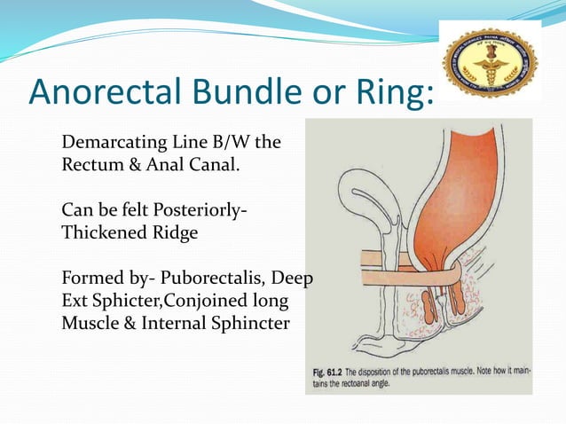 PPT by Dr Anil Kumar, Assitant Professor, AIIMS,Patna on Anal Fissure & Fistula in Ano | PPTX ...