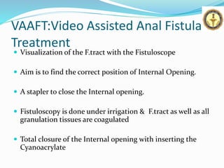Anal fissure & fistula in ano PPT By Dr Anil Kumar, Assistant Professor ...