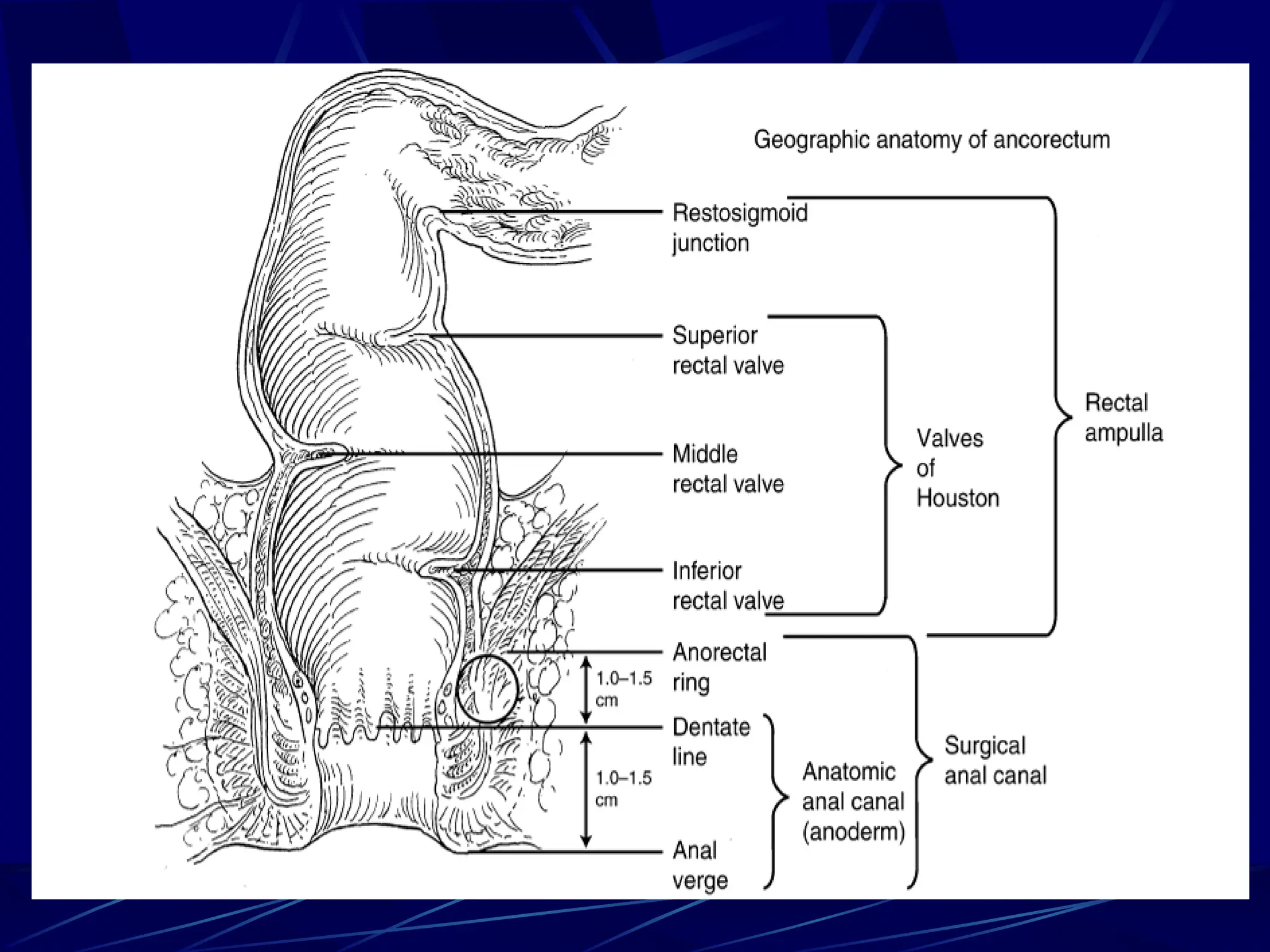 Anal fissure non surgical tt the lect.ppt