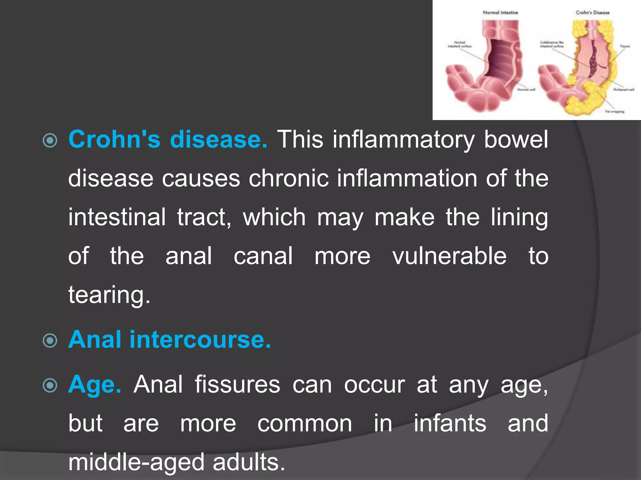 Anal fissures | PPTX