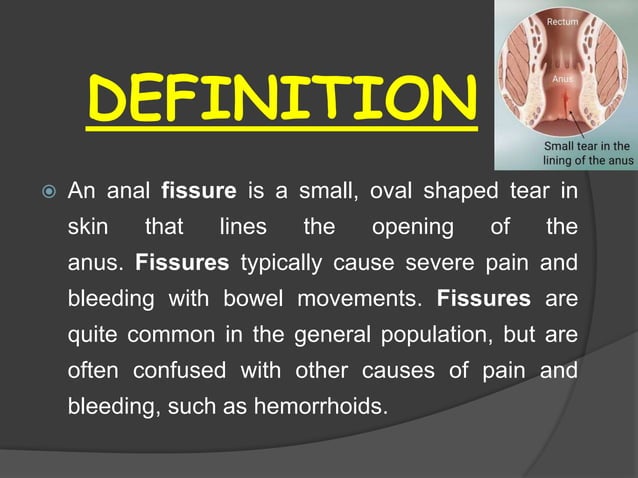 Anal fissures | PPTX | Digestive Disorders | Diseases and Conditions
