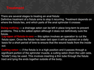 Anal fistula.. by. dr.saleh bakar.. taishan medical university | PPT