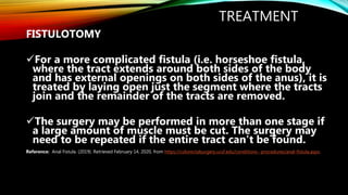 Anal Fistula | PPTX