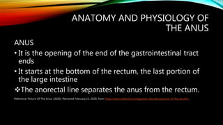 Anal Fistula | PPTX