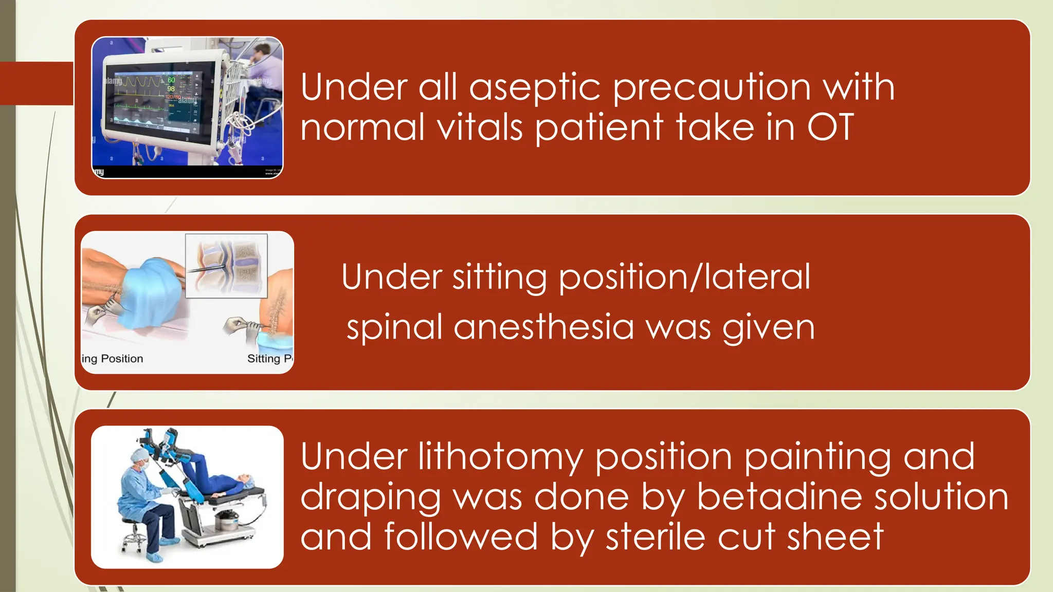 internal anal septectomy most common surgical procedure for chronic ...