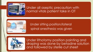 internal anal septectomy most common surgical procedure for chronic ...