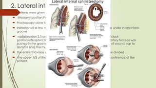 internal anal septectomy most common surgical procedure for chronic ...