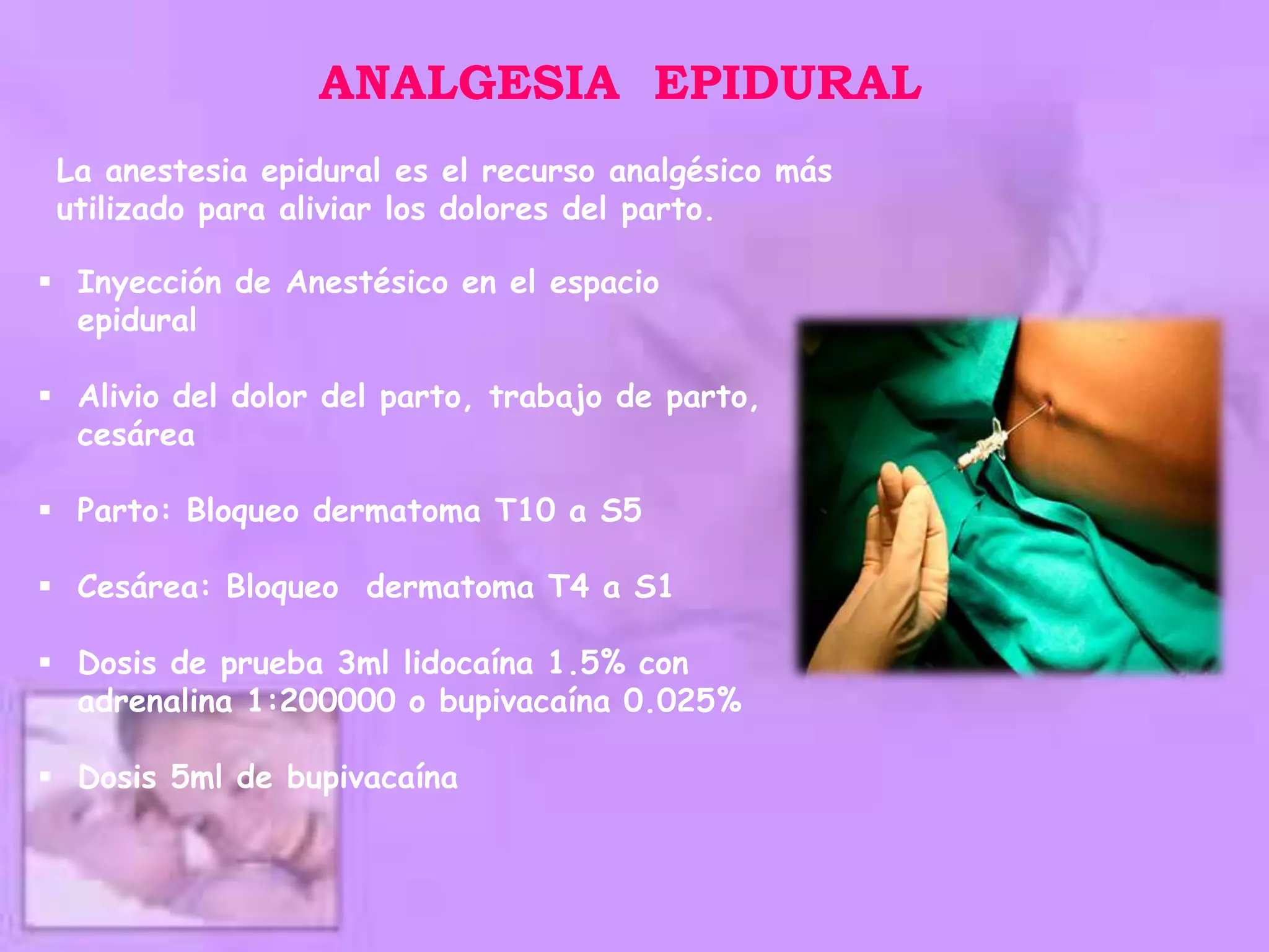 Analgesia en la labor de parto | PPT