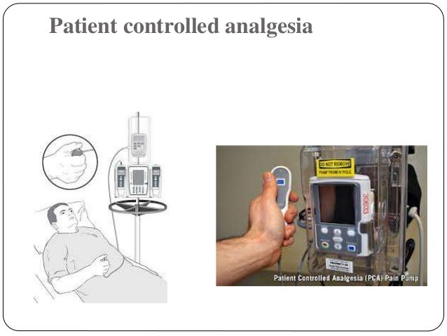 Analgesia in thoracic surgery.