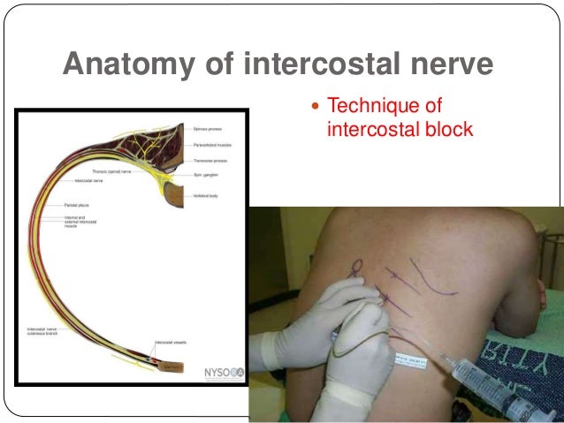 Analgesia in thoracic surgery.