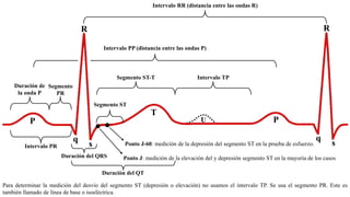 Analisis de-las-ondas-segmentos-e-intervalos-del-ecg.pdf analisis-de ...