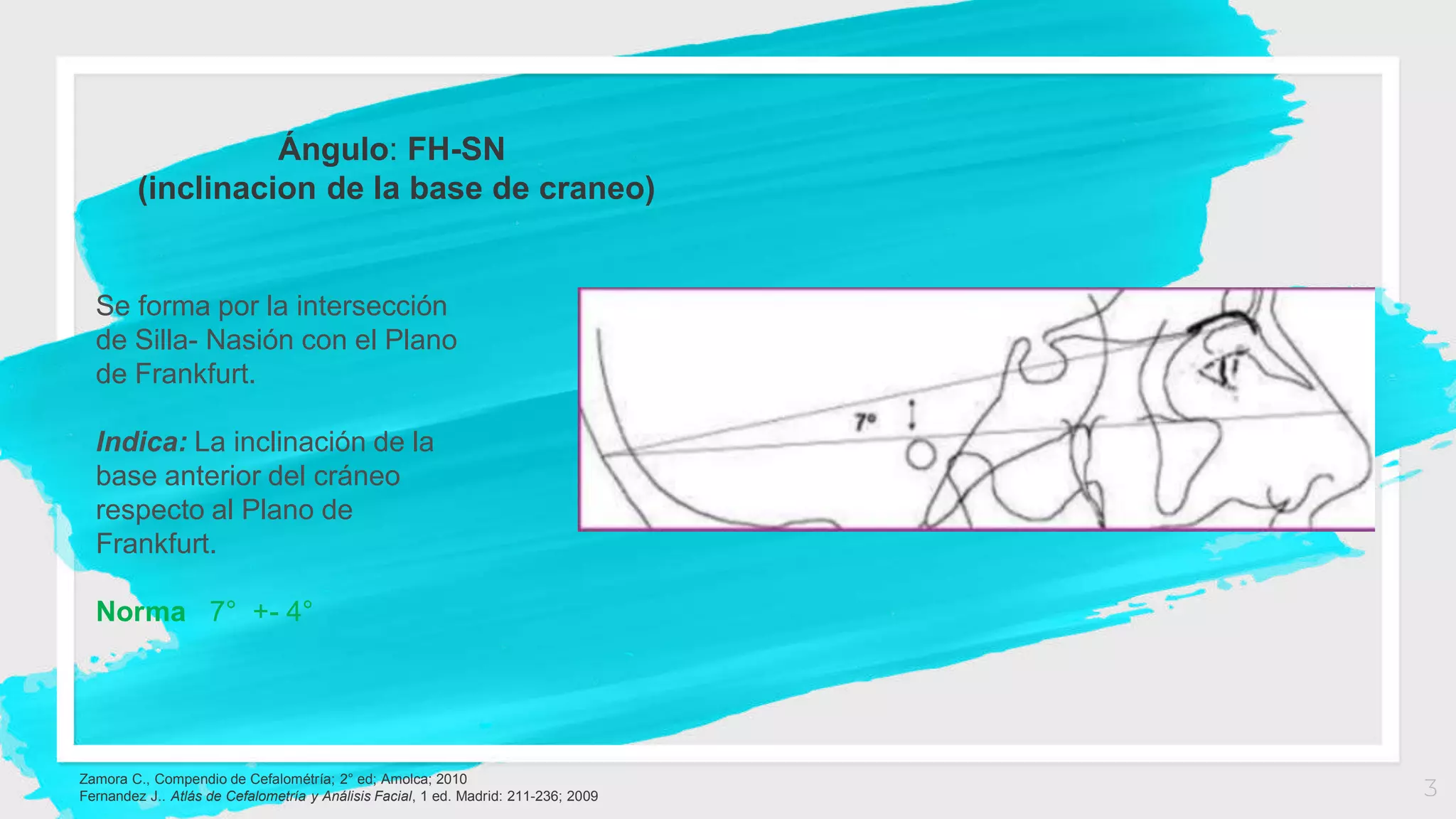 analisis angular- cefalometria medidas corregidas-2.pptx
