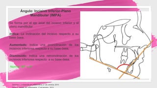 analisis angular- cefalometria medidas corregidas-2.pptx
