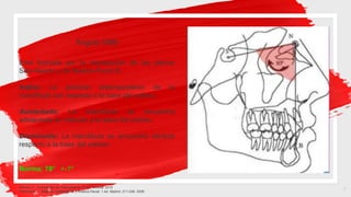 analisis angular- cefalometria medidas corregidas-2.pptx