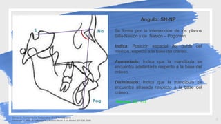 analisis angular- cefalometria medidas corregidas-2.pptx