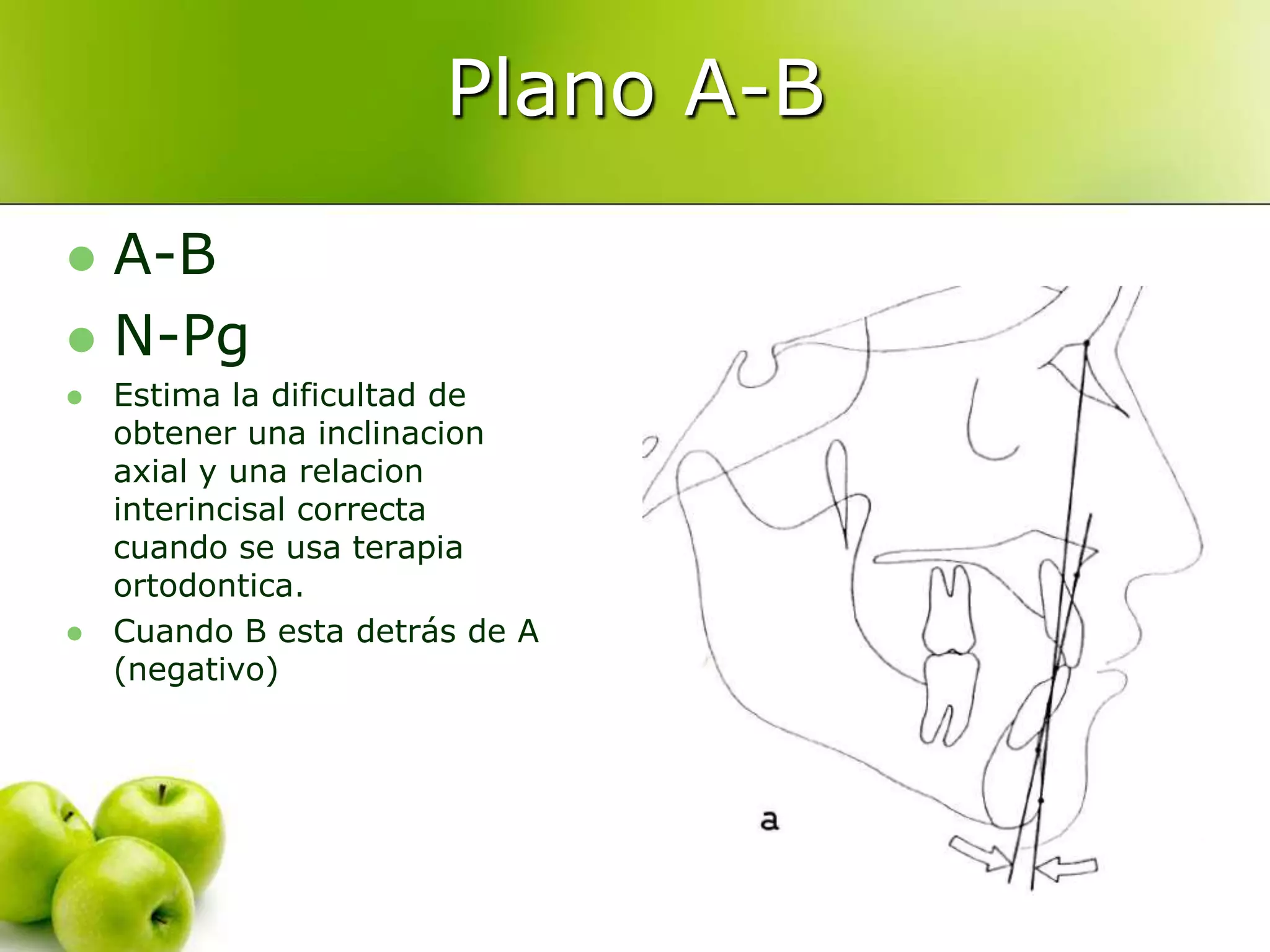 Analisis de downs | PPTX | Dental Health | Diseases and Conditions