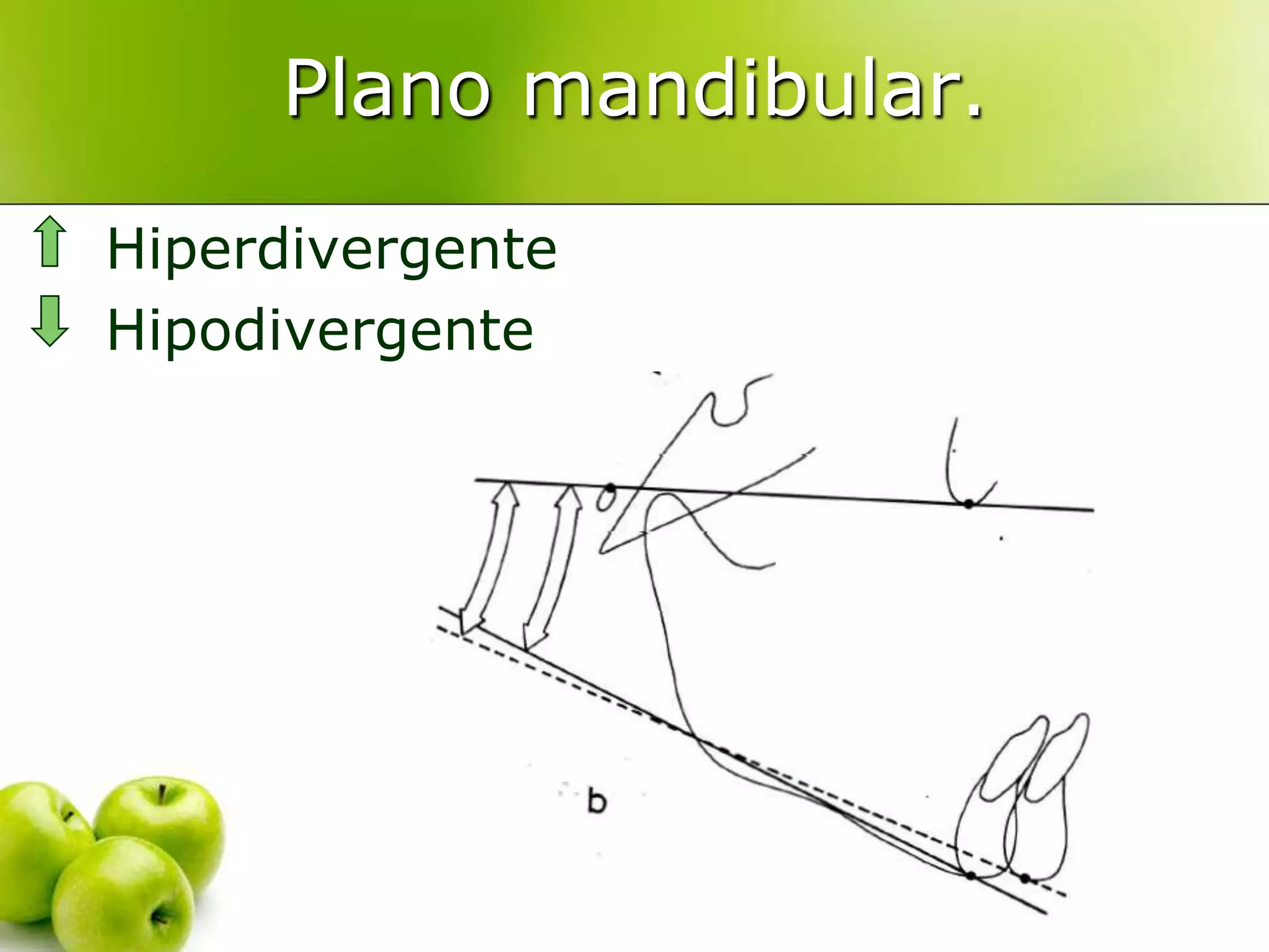 Analisis de downs | PPTX | Dental Health | Diseases and Conditions