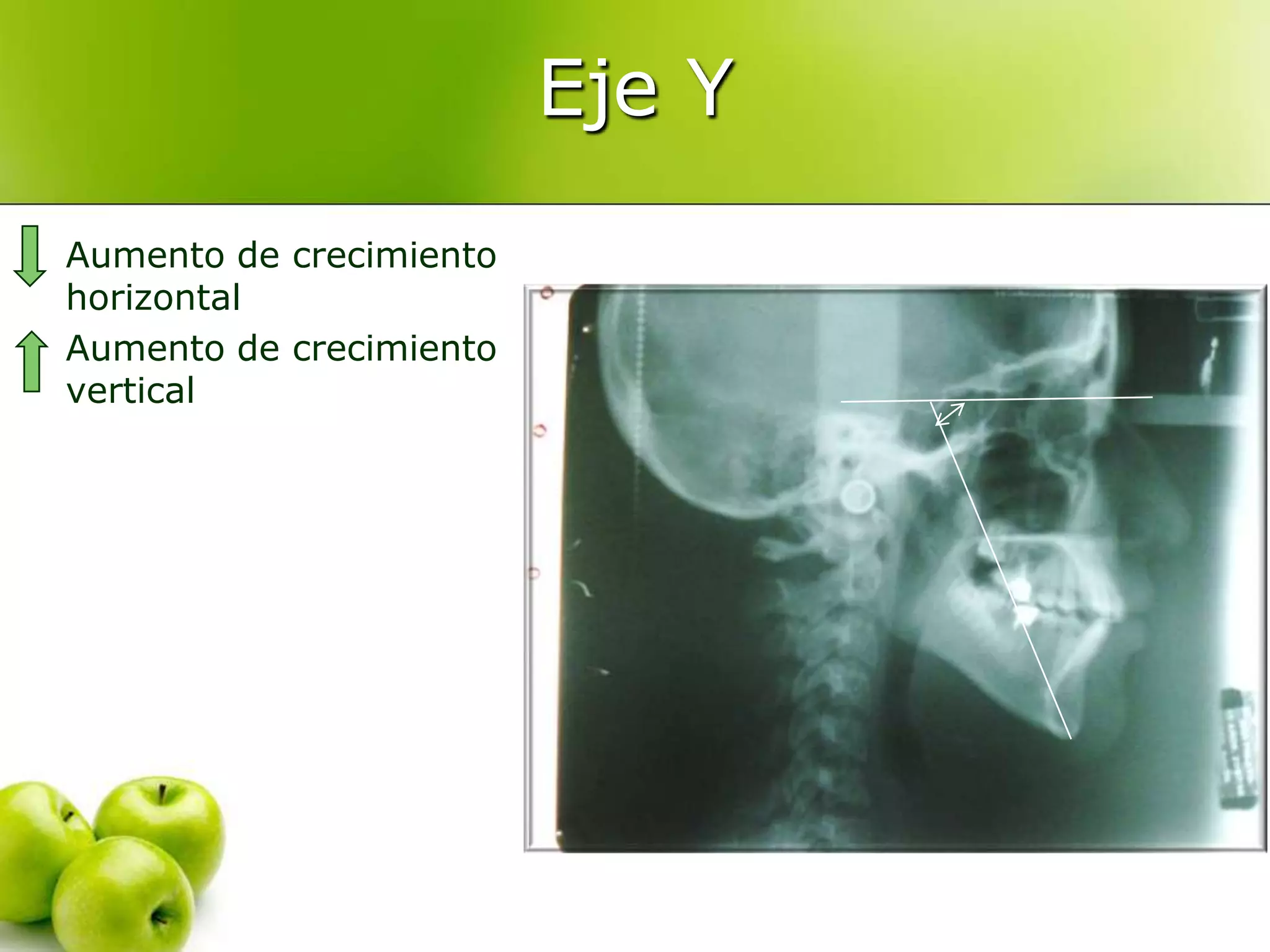 Analisis de downs | PPTX | Dental Health | Diseases and Conditions