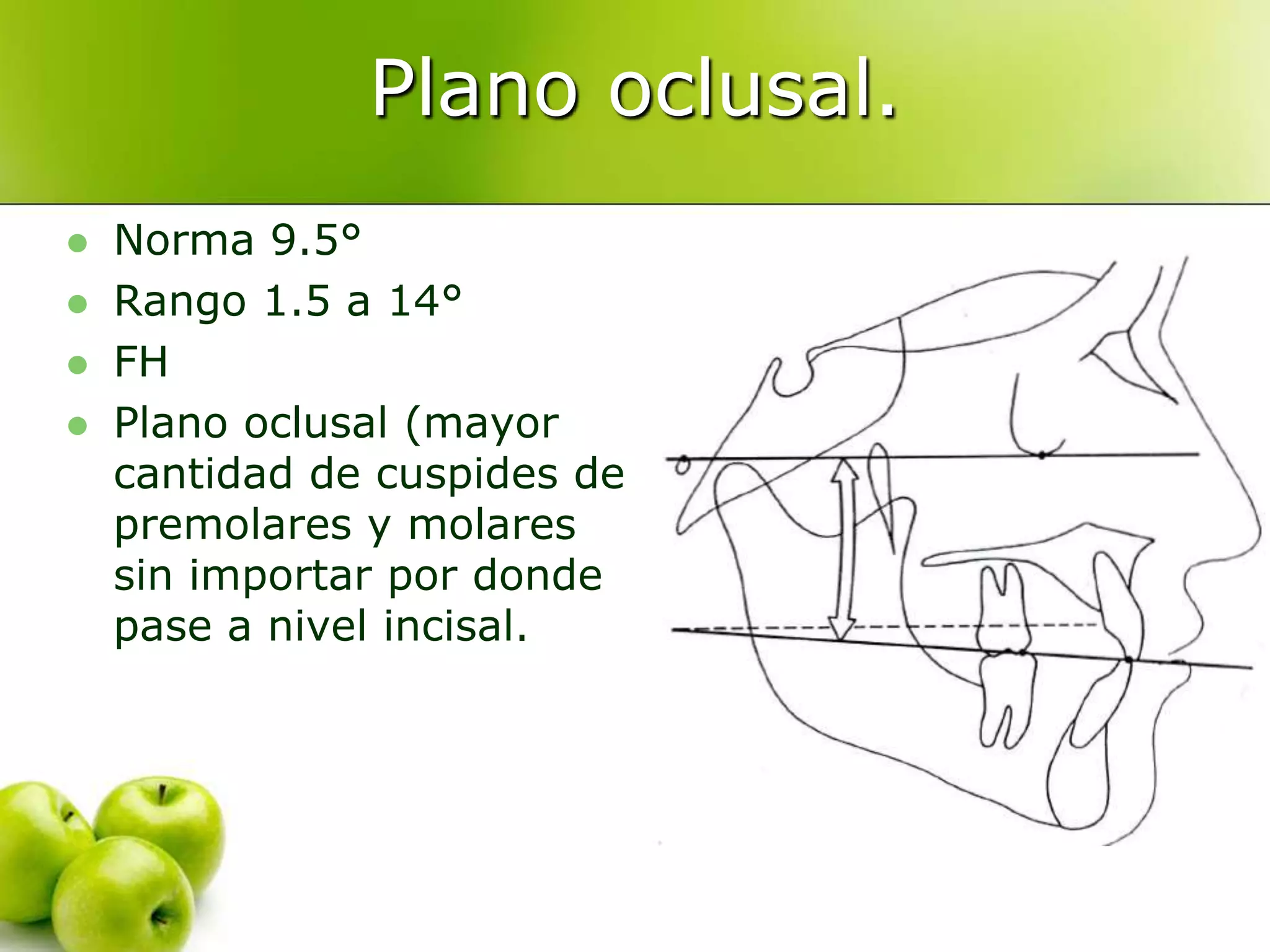 Analisis de downs | PPTX | Dental Health | Diseases and Conditions