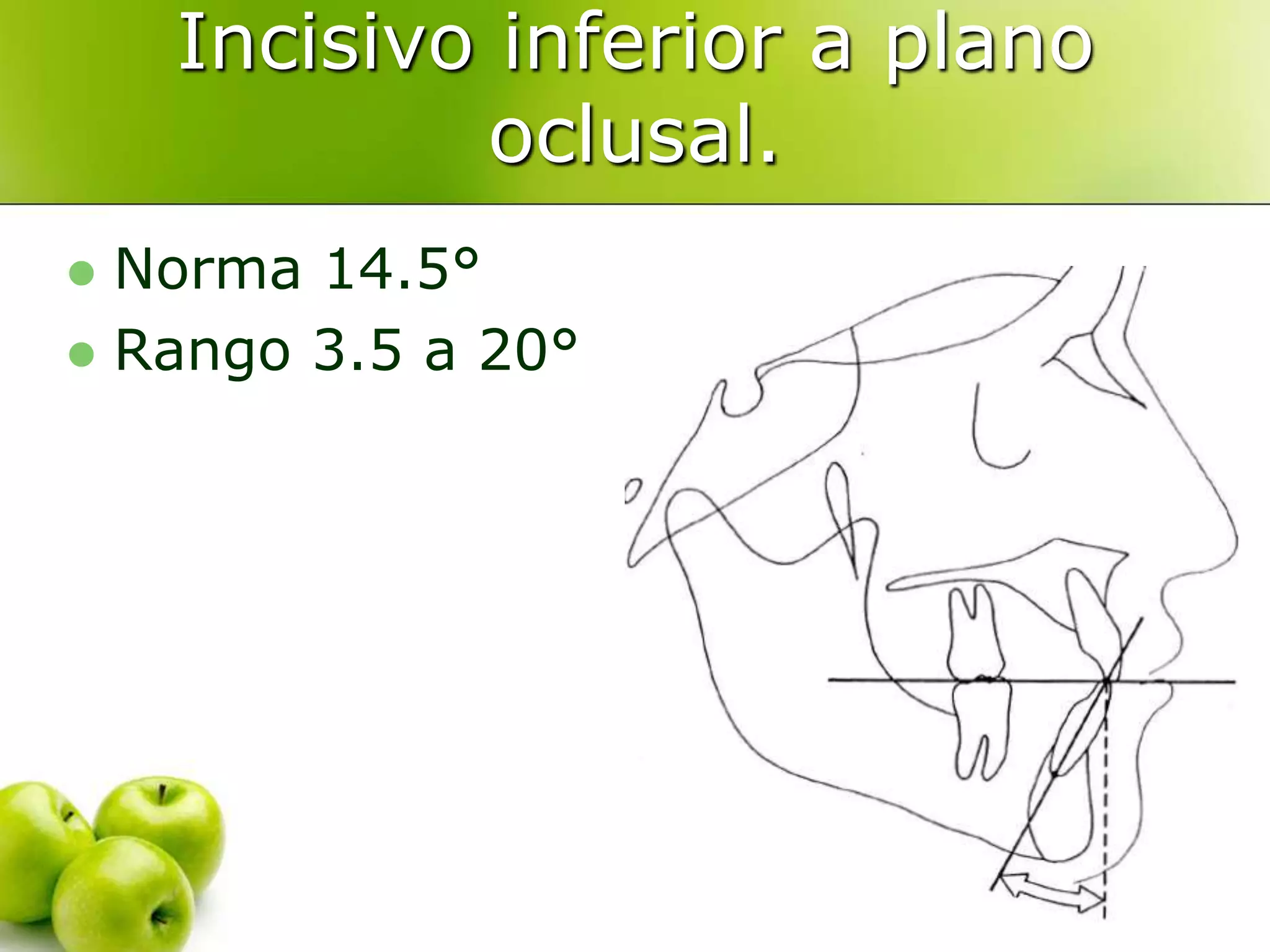 Analisis de downs | PPTX | Dental Health | Diseases and Conditions