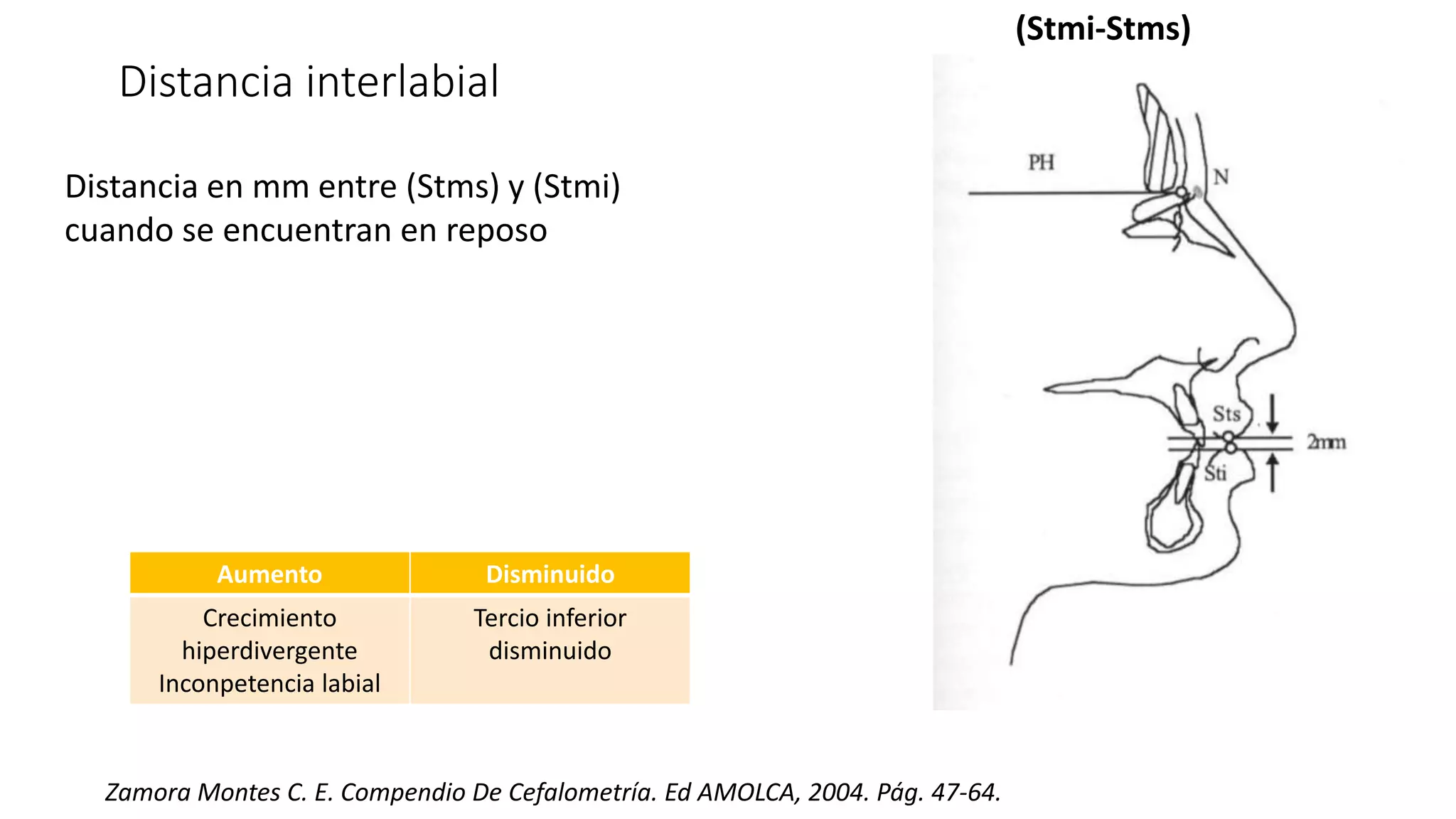 Análisis de dr Legan y burstone.pptx