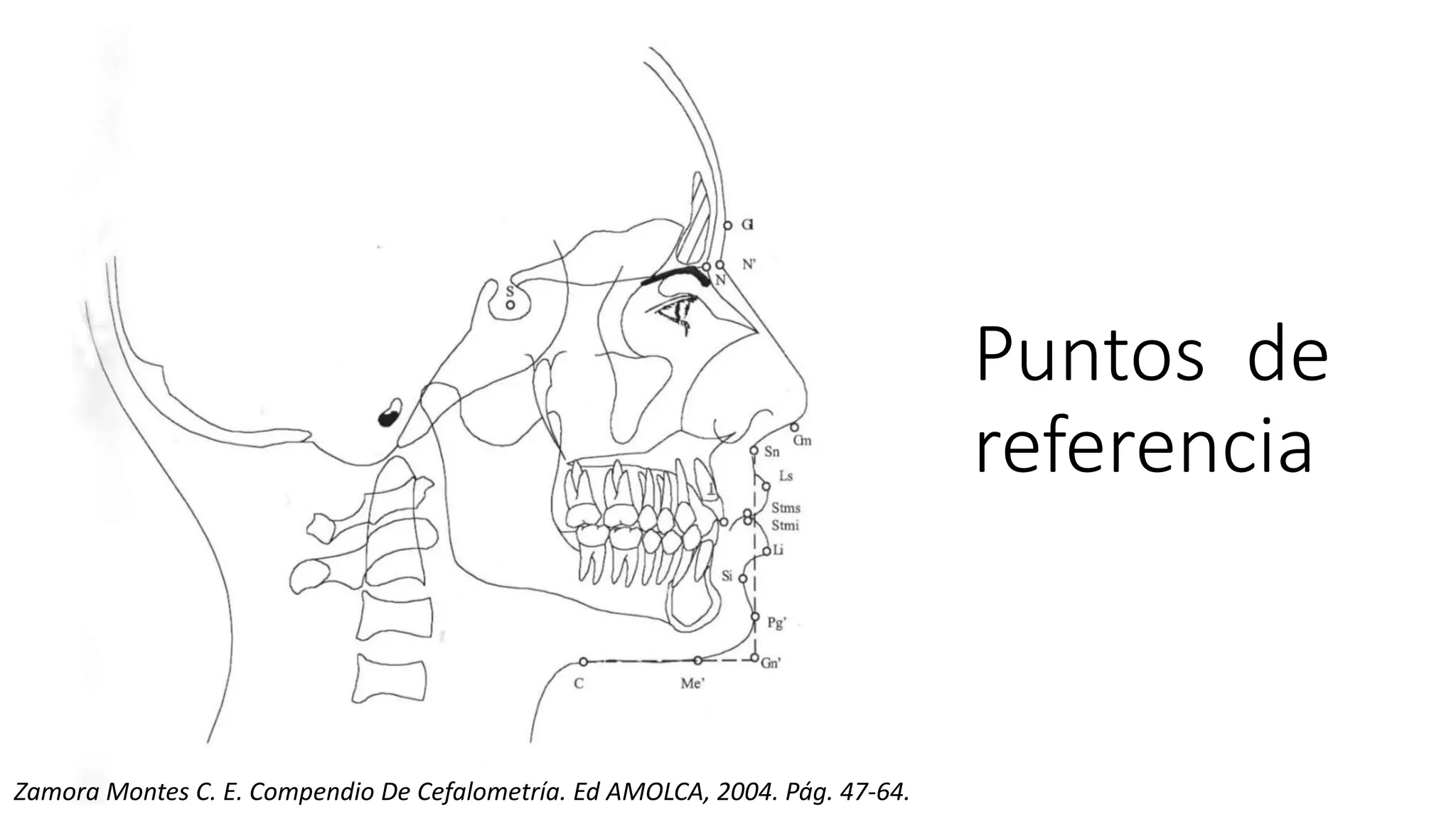 Análisis de dr Legan y burstone.pptx