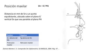 Análisis de dr Legan y burstone.pptx