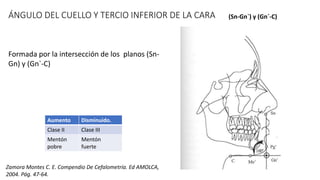 Análisis de dr Legan y burstone.pptx