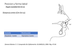 Análisis de dr Legan y burstone.pptx