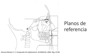 Análisis de dr Legan y burstone.pptx
