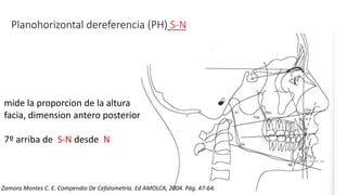 Análisis de dr Legan y burstone.pptx