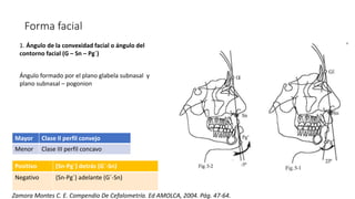 Análisis de dr Legan y burstone.pptx